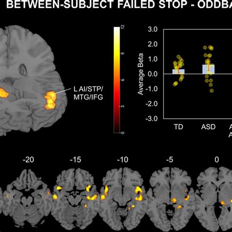 Whole Brain Between Subject Clusters Of Activation During Failed Stop