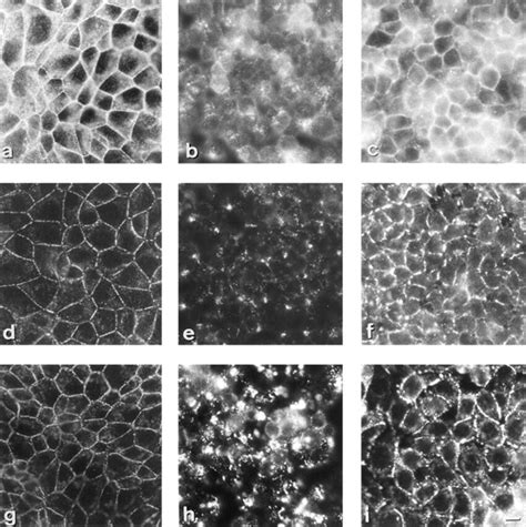 Relocalization Of Desmosomal Proteins To Cellcell Contacts Upon Tpa