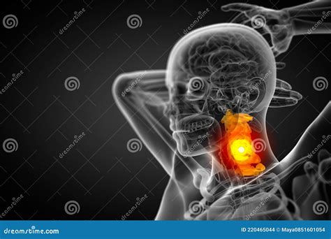 3d Render Medical Illustration Of The Cervical Spine Stock Illustration