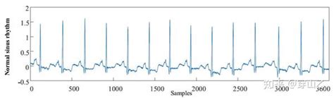 基于深度学习的ecg分类 三 ——基本模型的复现与改进：cnn Gru 知乎