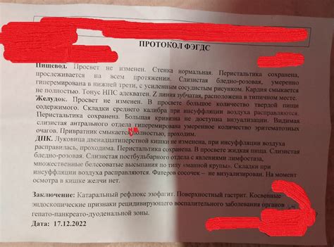 ГЭРБ Катаральный рефлюкс эзофагит Вопрос гастроэнтерологу 03 Онлайн