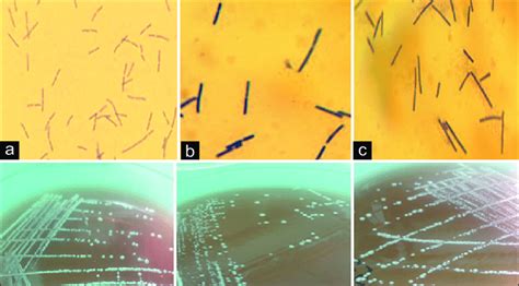 Microscopic Image ×100 And Mrs Agar Based Colonys Morphology Of