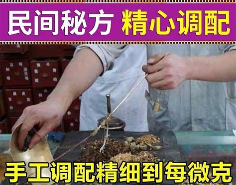 牛皮癣银屑病狼毒外用皮炎湿疹止痒去根药膏可带备票值粗实线其他 虎窝淘