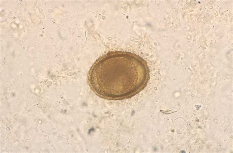 Toxocara Canis Egg