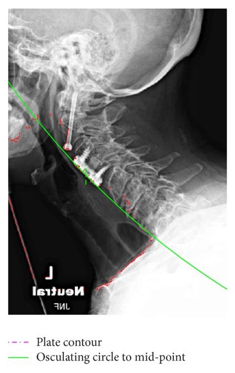 Fitted Plate Contour Dashed Line And Osculating Circle Continuous Download Scientific