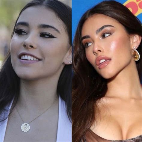 Madison Beer Plastic Surgery Madison Beer Plastic Surgery Plastic