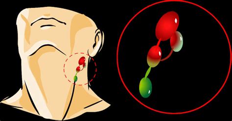 7 Easy Ways To Quickly Unclog Your Lymph Nodes To Reduce Swelling And Flush Out Toxins