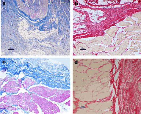 Light Micrographs Of Paraffin Embedded Sections 21 Days Post Download Scientific Diagram