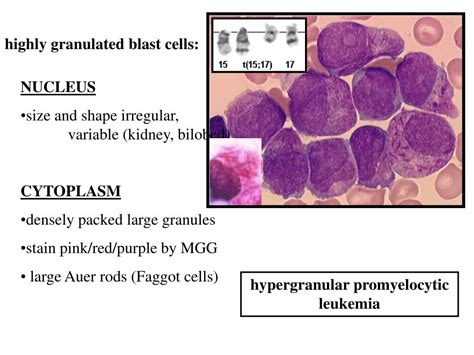 Ppt Chromosome Aberrations In Haematologic Malignancies Powerpoint