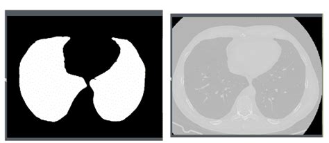 Introduction To Medical Image Processing With Python Ct Lung And