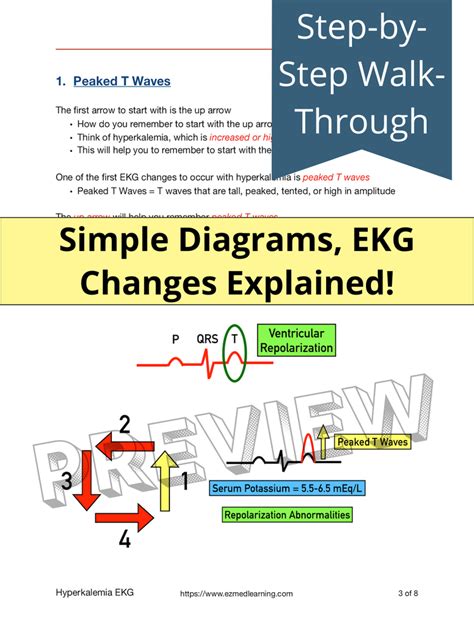 5 Lead Ecg Placement Electrode Locations Explained Mnemonic For