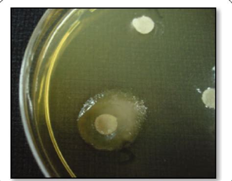 Mucoid Colony Cryptococcus Mycology University Of Adelaide