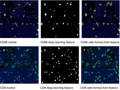 Spatial Phenotyping In Digital Pathology Defining A Multiplex If Image