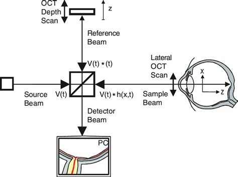 standard oct scheme based on a low time coherence michelson