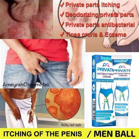Ntibacterial Cream 20g Dermovate Ointment Original Skin Rash Cream Skin