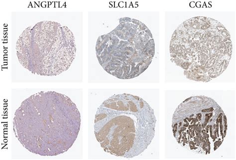 Genomic Mutation Profiles Of Different Risk Groups And Genes A