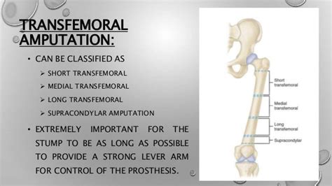 Lower Limb Amputation