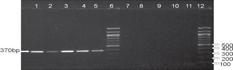 Pcr Amplification Of Sex Specific Ecor1 Fragment Sequence Ee06 Using Download Scientific