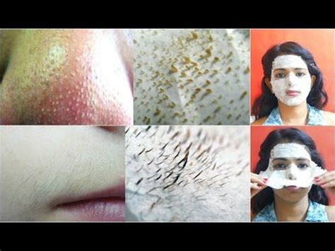 How To Remove Black Hairs On Nose Top Furniture Brands