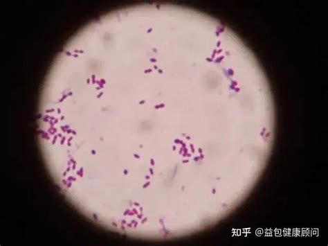 慢阻肺患者疫苗接种季——肺炎球菌疫苗简介 知乎