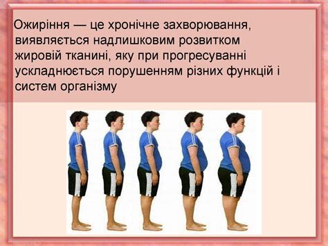 Ожиріння. Причини ожиріння у дітей - презентация онлайн