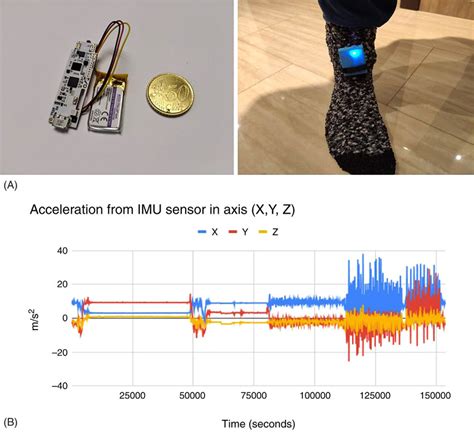 1 A Low Cost Noninvasive Inertial Sensor That Can Be Attached To Download Scientific Diagram
