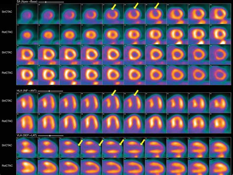 The Role Of Noninvasive Cardiac Imaging In The Management Of Diseases