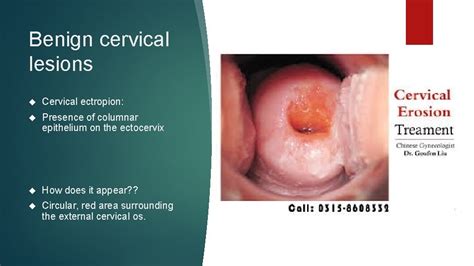 Benign Diseases Of The Uterus By Amin Alajlouni