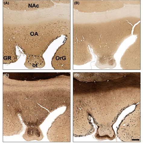 Acetylcholinesterase Distribution In The Primary Olfactory Gyrus A