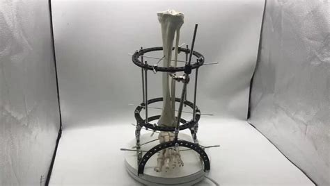 External Fixator Orthopedic Instruments Surgical Fixation Instrument Box Ilizarov Fixation