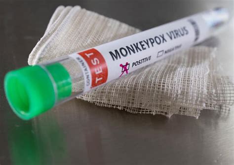 Premier cas du nouveau variant mpox détecté en France