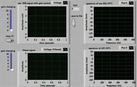 10 Eeg Plotter Control And Display Panel On A Computer Download Scientific Diagram