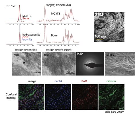 Bone Calcification Duer Research Group