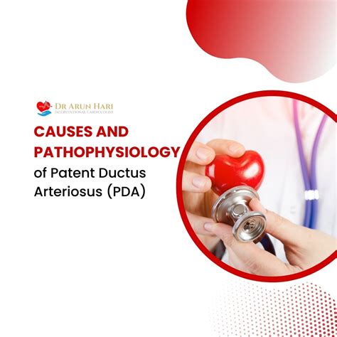 Dr 🫀 Understanding Patent Ductus Arteriosus Pda A Congenital