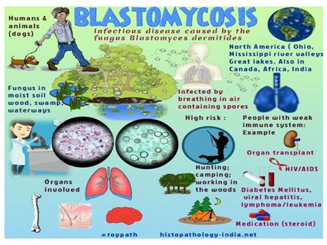 A Comprehensive Ppt On Blastomycosispptx