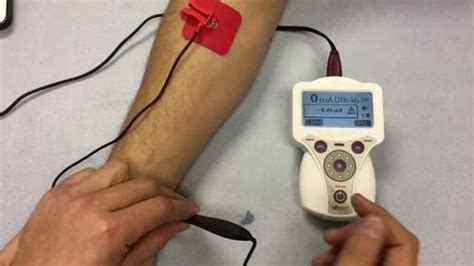 Stimpod Nms460 A Non Invasive Pulsed Radiofrequency Prf System Pain
