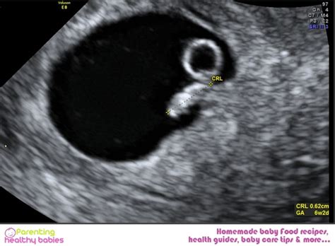 Week Of Pregnancy Pregnancy Week By Week