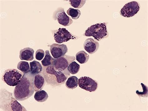Basophilic Meningitis Stock Image Image Of Microscope 281301255