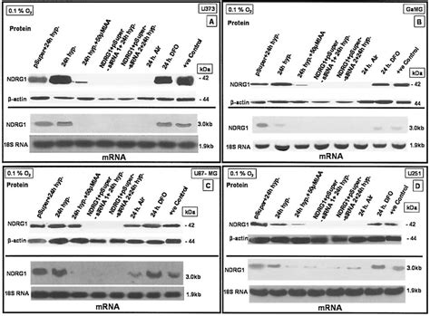 Inhibition Of Ndrg1 Protein And Mrna Expression In 4 Different Human