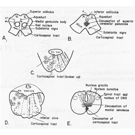 The Stalk Like Brainstem Neuroanatomy Andreas Vesalius 1514 1564