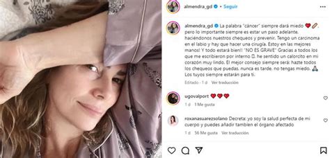 Almendra Gomelsky Con Cáncer Y Se Someterá A Intervención Tengo Un