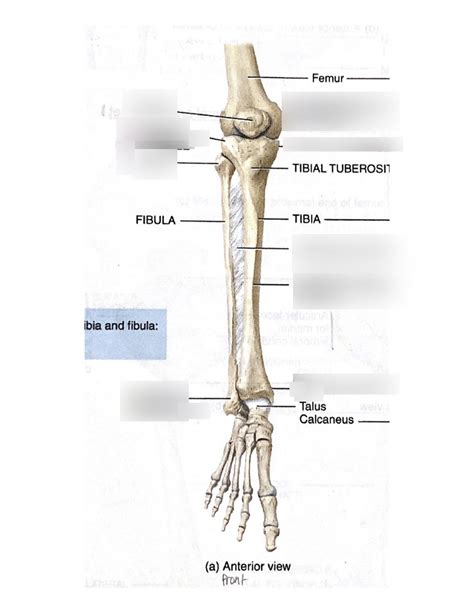 Lab Lower Extremity Bones Tibia Fibula Diagram Quizlet