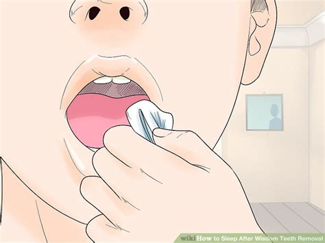 How To Sleep After Wisdom Teeth Removal 10 Steps With Pictures