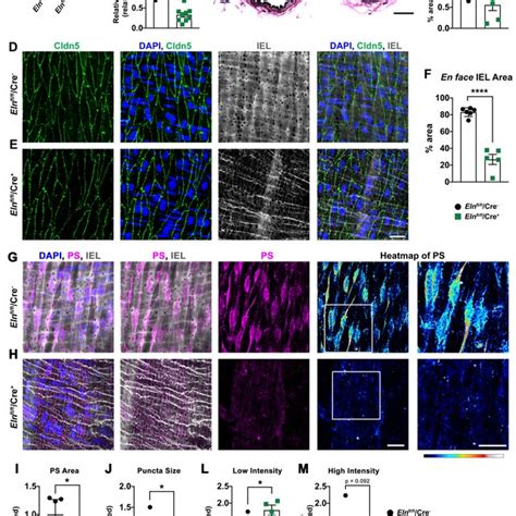 Eln Fl Fl Cre Mice Have Disrupted Ps Localization In Endothelium
