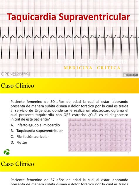Taquicardia Supraventricular Pdf Electrocardiografia Electrofisiologia