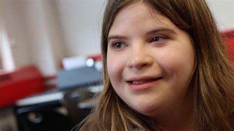 Down Syndrome Teenagers