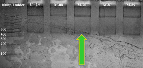 Pcr Sscp Of Aoc1 Exon 4 L1 100bp Marker L2 Control And L3 L6