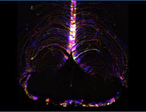 High Resolution Transcriptome Analysis With Long Read Rna Sequencing