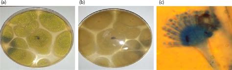 Figure 5 From Isolation And Morphological Identification Of Aspergillus Species From Some