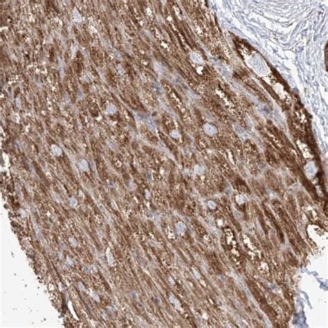 Phospholipase C Like 1 Antibody Novus Biologicals™ 0 1ml Unlabeled